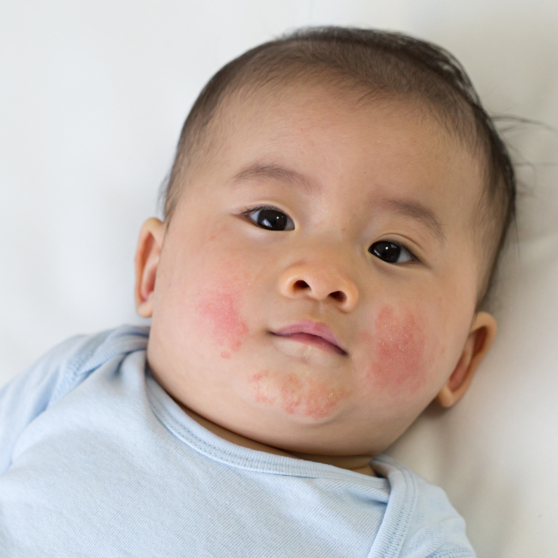 Useful home remedies for teething babies & the impact on solid foods ...