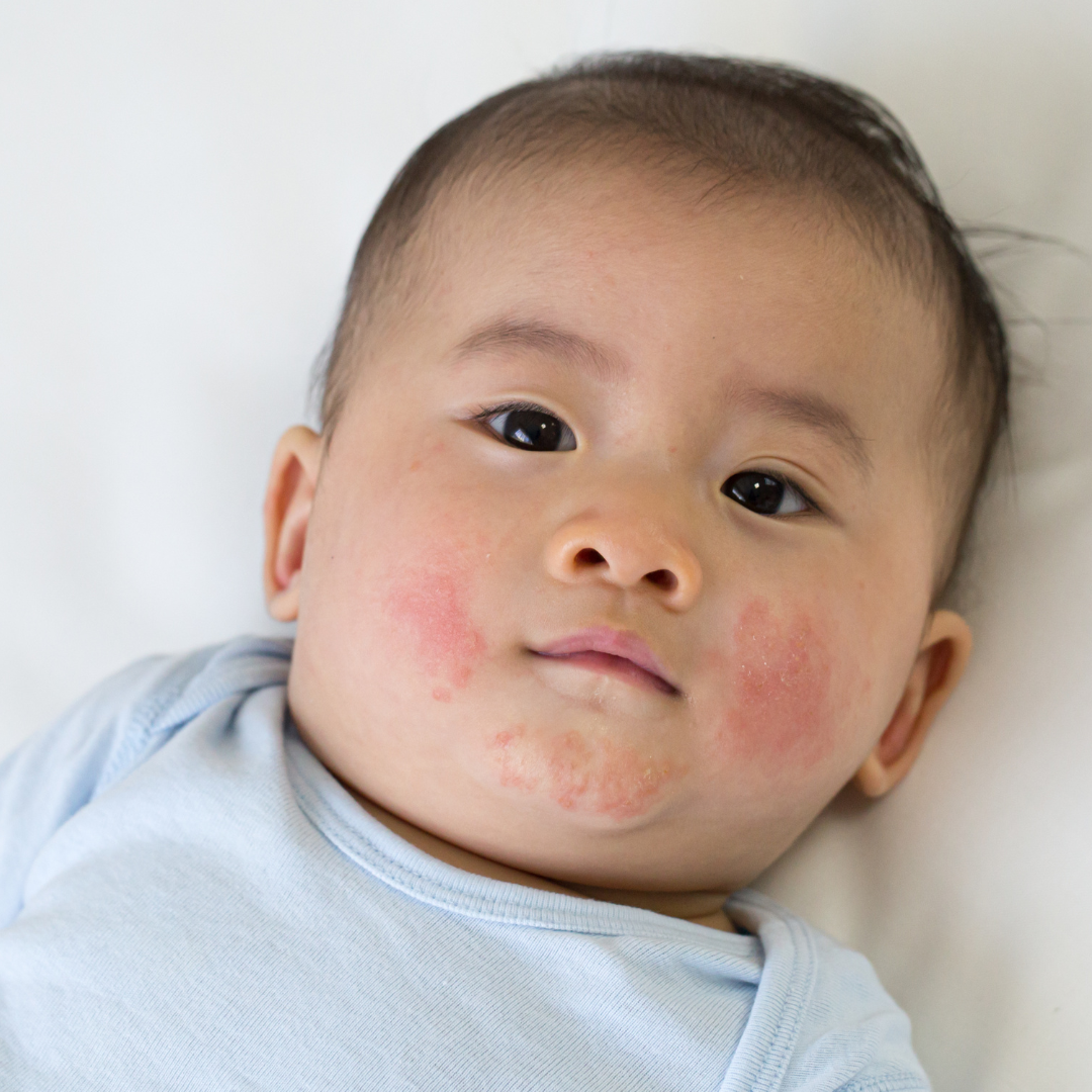 Useful home remedies for teething babies & the impact on solid foods ...