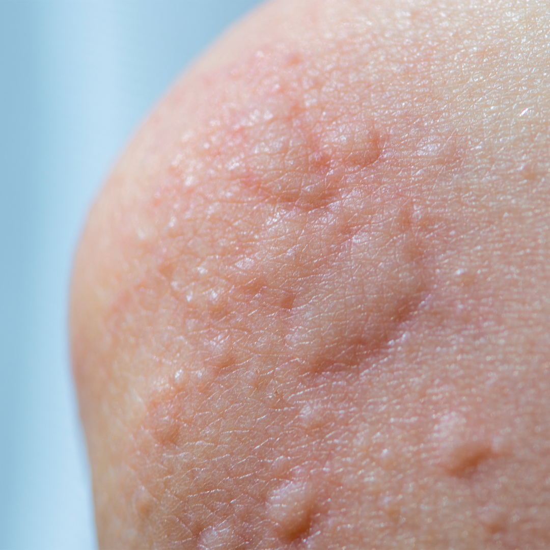 The research you need to know on introducing eggs to baby as a priority ...